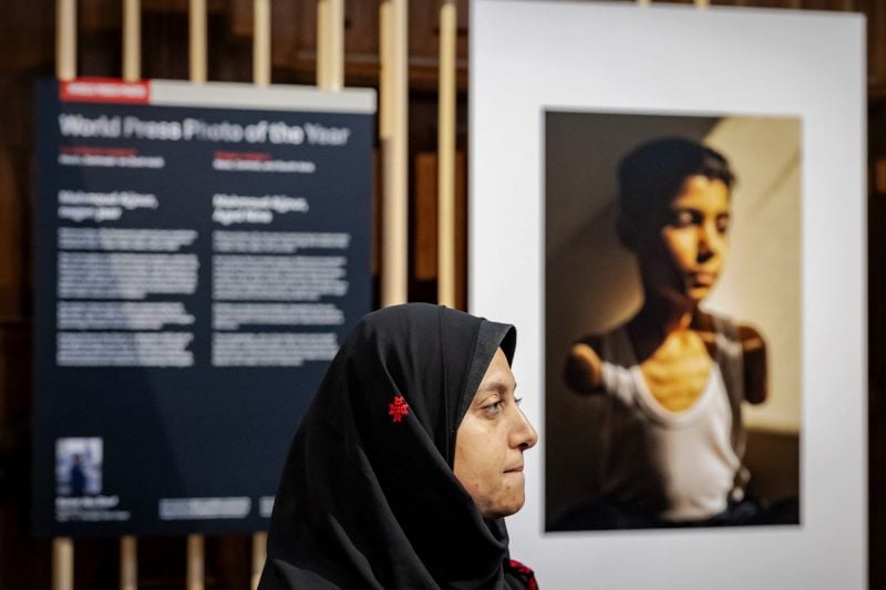 Portrait of amputee Palestinian child wins World Press Photo - L'Orient ...