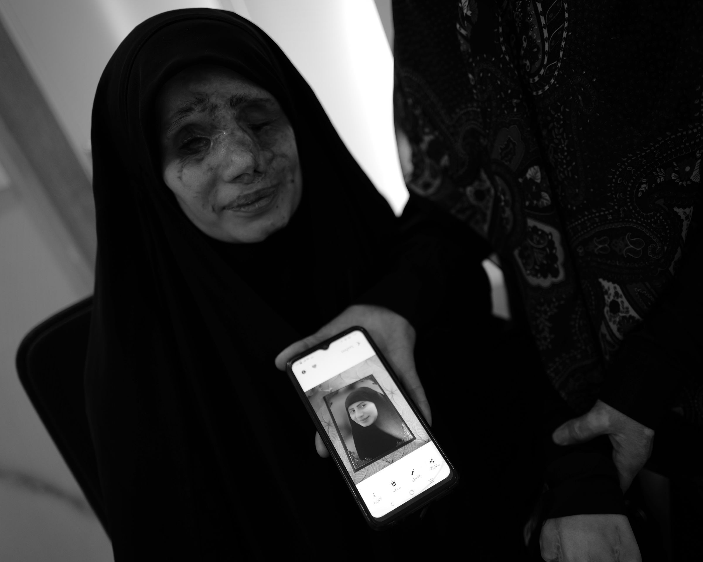 One year on, scars of the Hezbollah pager attack: A crack in the armor ...